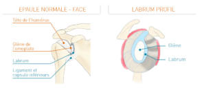 Luxations d’épaule – Chirurgie Orthopédique & Sportive Paris – Val de Marne